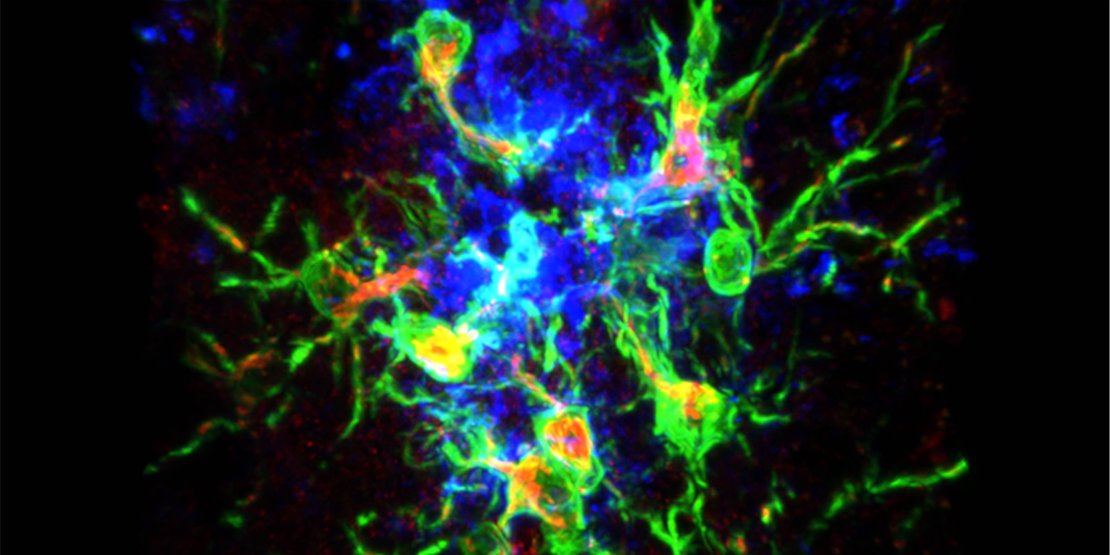 FIU Training in Environmental Neuroscience
